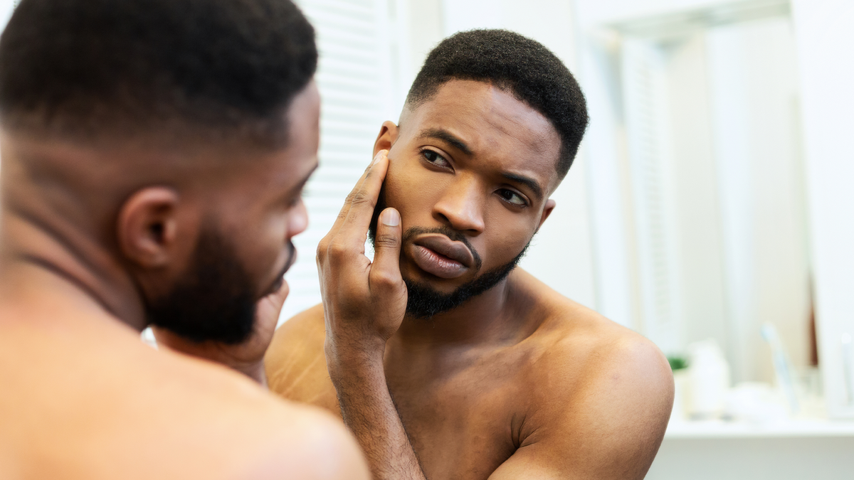 Do SARMs Cause Acne? [What You Need To Know!] – CrazyBulk Canada